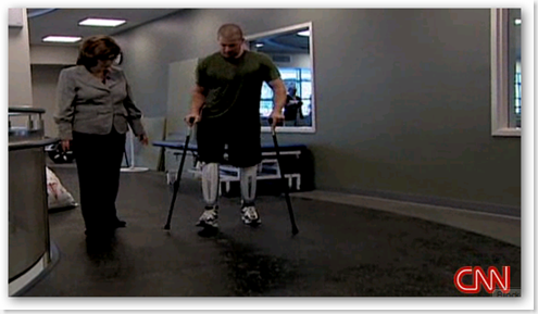 Double amputee walks again due to Bluetooth - Medical Quack
